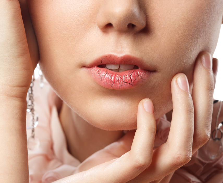 5 Ways To Kiss Goodbye Dry Cracked Lips School Mum